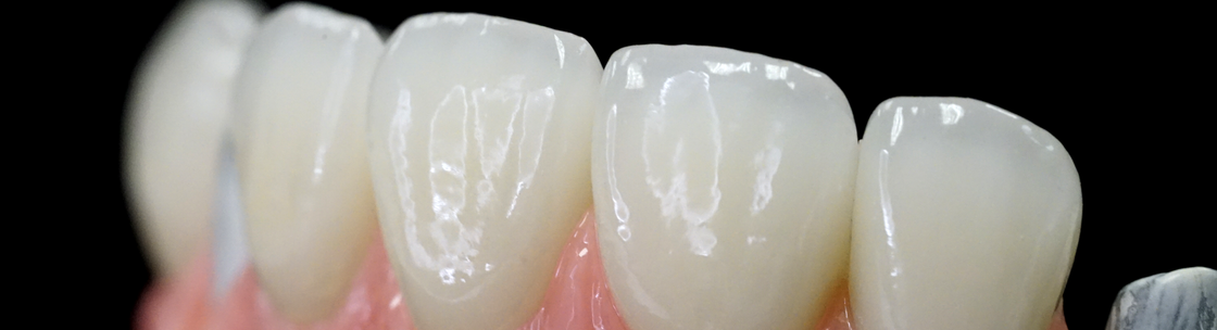 IPRO Dental Laboratory - A Rite Smile Company - Alignable