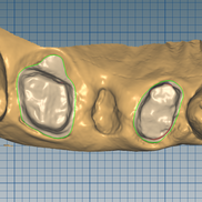 Flaherty Dental Laboratory, Inc. - Greenwood, IN - Alignable