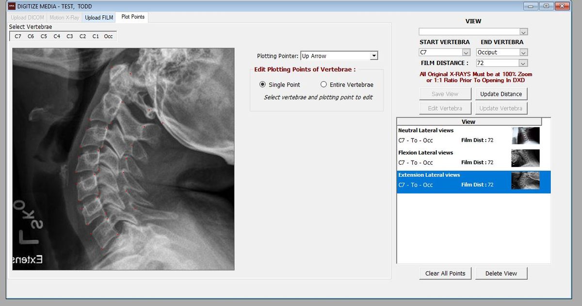 Chiropractors: When using the George lines method, would it not be more ...