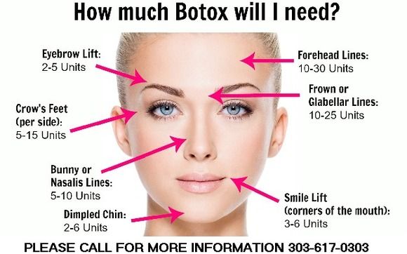 SPECIAL FOR BOTOX $ 9.00 PER UNIT by Eagle Bend Dental Center.PLLC in ...