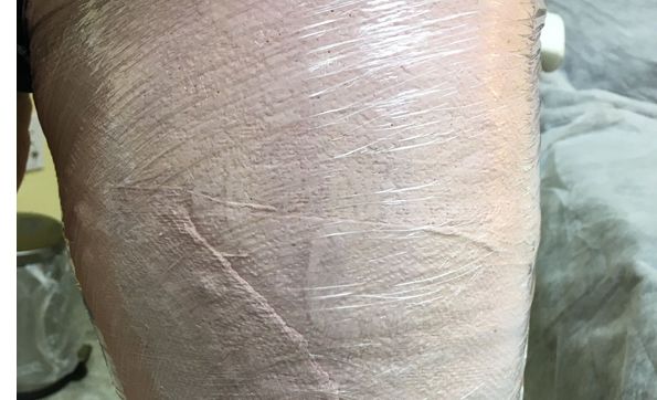 Yesotherapy Leg Wrap by Menoskin in Palm Bay, FL - Alignable