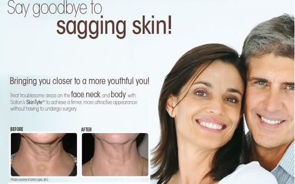 3 Sciton SkinTyte® TREATMENTS FOR $700!!!! by Med Spa At Seena One in ...