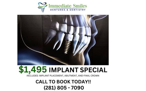 Dental Implants by Immediate Smiles Dentures & Dentistry in Spring, TX ...