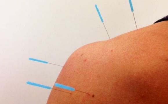 Health Services by IN8 Family Chiropractic P.A. in Tucson, AZ - Alignable