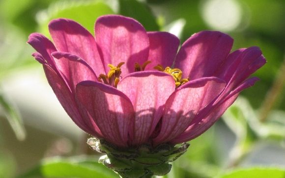 Assessment Tool for Lingual Frenulum Function (ATLFF) by Cowichan ...