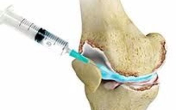 Viscosupplementation by Ozzie Smith IMAC Regeneration Center in ...