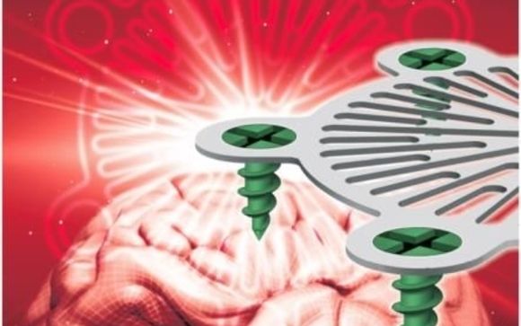 Cranial Plating System by CMF Medicon Surgical in Jacksonville, FL ...