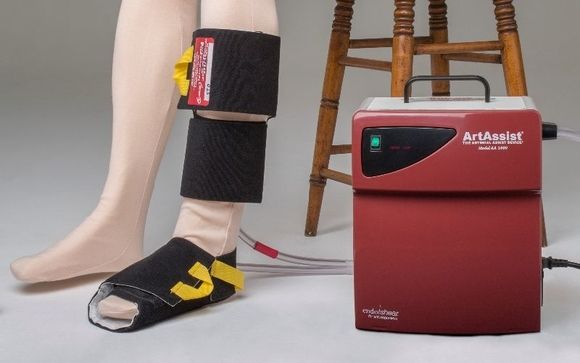 ArtAssist Device- San Diego County #1 leader in Limb Amputations in the ...