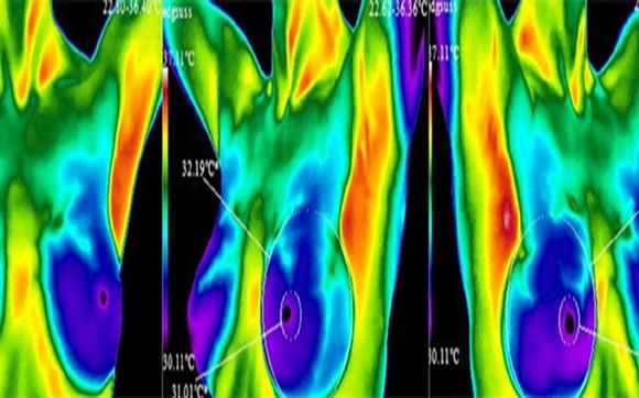 HEALTH IMAGING by Body Thermal Imaging in San Diego, CA - Alignable