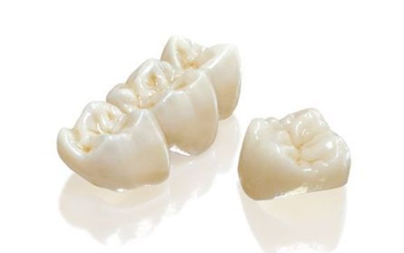 Sunflex Partials by Sun Dental Labs in Pinellas Park, FL - Alignable