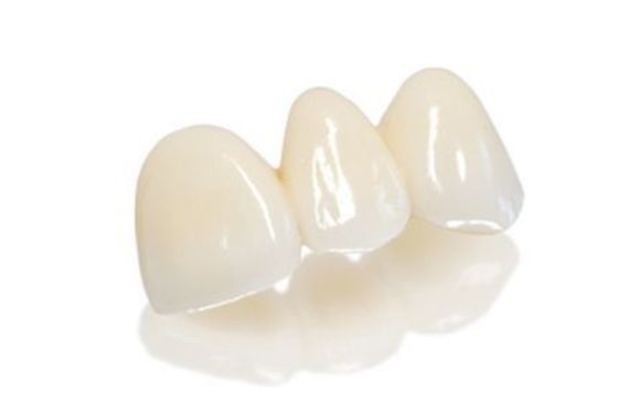 Sunflex Partials by Sun Dental Labs in Pinellas Park, FL - Alignable