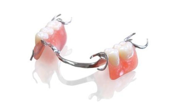 Sunflex Partials by Sun Dental Labs in Pinellas Park, FL - Alignable