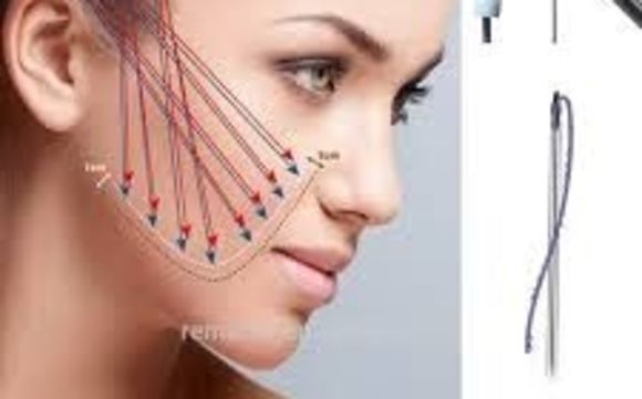 HA CE Hyaluron Injectables by Notox & Fill Botox & Fillers Facelift ...