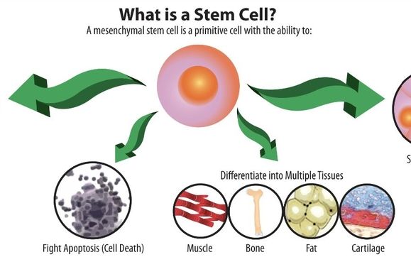 Stem Cells Injection Therapy for chronic knee, shoulder and other joint ...