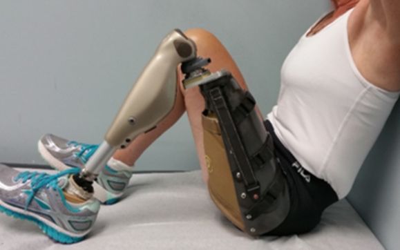 User Adjustable Prosthetic Socket, Sail Socket by CJ Socket ...