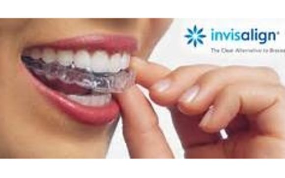 Invisalign by Heather M. Wilmore, DDS in Houston, TX - Alignable