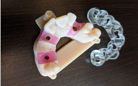 3D Printed Dental Implant Models & Surgical Guides by Proto3000 in ...