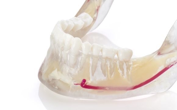 3D Printed Maxillofacial Surgery Models by Proto3000 in Woodbridge, ON ...