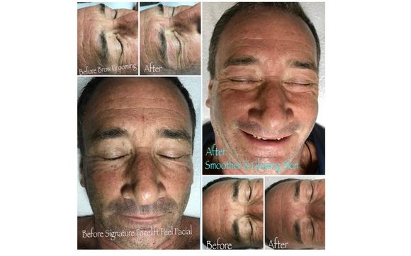 Signature Facelift Facial by Kim King @ Lasting Image in Tampa, FL ...