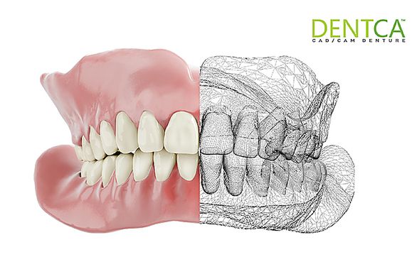 3D Printable Denture Design Services for Dental Laboratories by Dentca ...