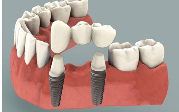 BDC Dental - Calgary, AB - Alignable