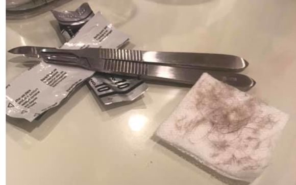 Dermafile Facial by Brenda's Beautiful Skin Studio in Oklahoma City, OK ...