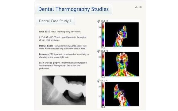 Thermal Cranial/Dental/Thyroid Imaging by Thermography Clinic Milton ...