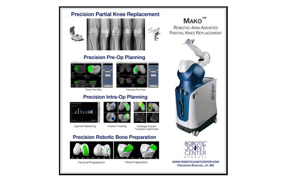 Partial & Total Knee Replacement: Frederick F. Buechel, Jr. MD: Stryker ...