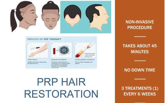 Platelet Rich Plasma (PRP) by Scottsdale Health By Dr. Nancy's ...