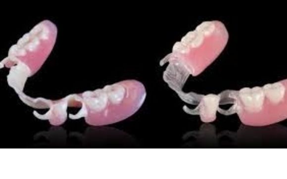 Metal Free Denture Partials (Zirlux Acetal, VisiClear) by Cypress ...