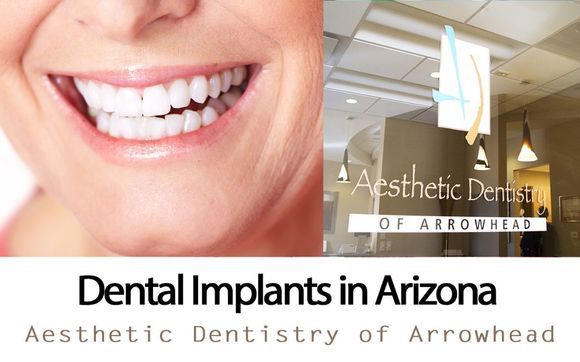 Arrowhead Dentist by Aesthetic Dentistry of Arrowhead in Glendale, AZ ...