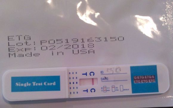 ETG ALCOHOL URINALYSIS TEST by Global Medical Systems, Inc in ...