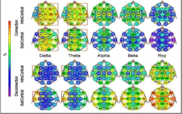 QEEG or Quantitative EEG by Neurofeedback and Neurorehab Institute in ...