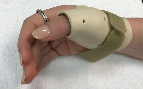 Custom Splinting by Ascend Hand Therapy in The Colony, TX - Alignable