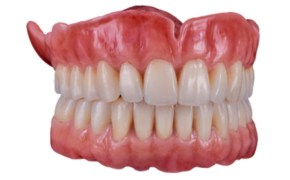 Digital Dentures by Dental Digital Design in Naples, FL - Alignable