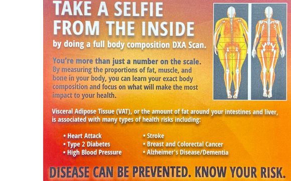 DEXA Scans, Full Body Composition and Bone Scan by Precision Health [by ... DEXA Scans, Full Body Composition and Bone Scan by Precision Health [by ...