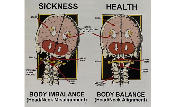 Atlas Orthogonal (Upper Cervical) Adjustments by Power On With Wiggins ...