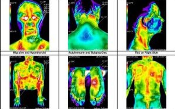 Full Body Scan by Safe Body Imaging in Henderson, NV - Alignable