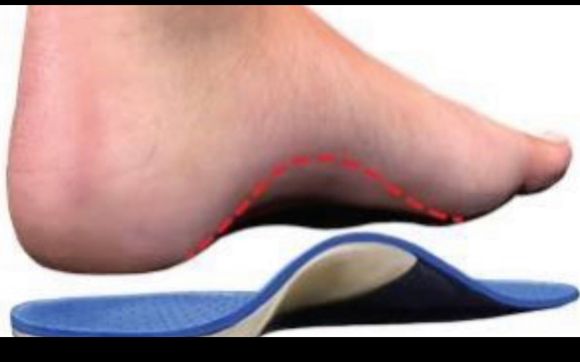 Custom made orthotics/insoles by Dixon Chiropractic and Spine Clinic in ...