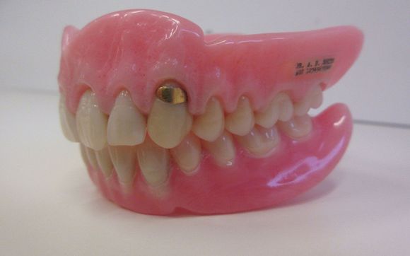 Full Upper and Lower Dentures by Schaefer Denture Clinic in Edmonton ...