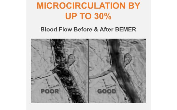 Before & After Blood Flow by Holistic Health Broker in Las Vegas, NV ...