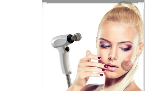 Micro plasma rf by Ultimate Natural Beauty & Skin Care in District of ...