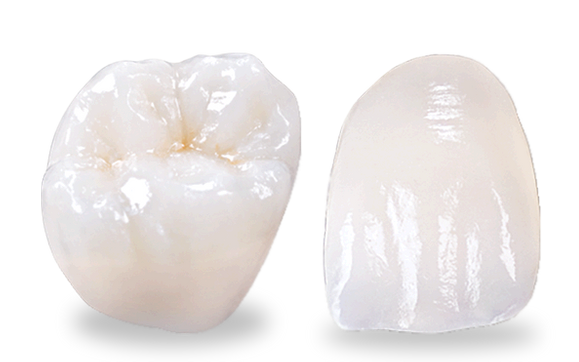 TCS Nesbit/Flipper by Rite Smile Dental Laboratory Network | PCDL ...