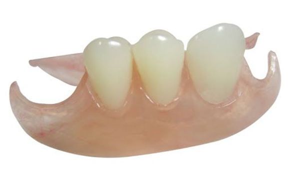 TCS Nesbit/Flipper by Rite Smile Dental Laboratory Network | PCDL ...