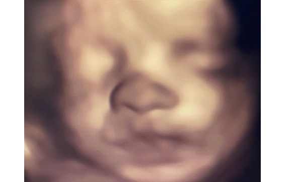 3D ultrasound by Sneak A Peek 4D Ultrasounds in Saint Charles, MO ...