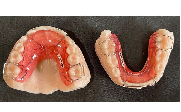 Traditional orthodontic retainers by Stellar Smiles Ortho in Grapevine ...