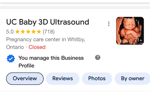 4d pregnancy ultrasound by UC Baby 3D Ultrasound in Whitby, ON - Alignable