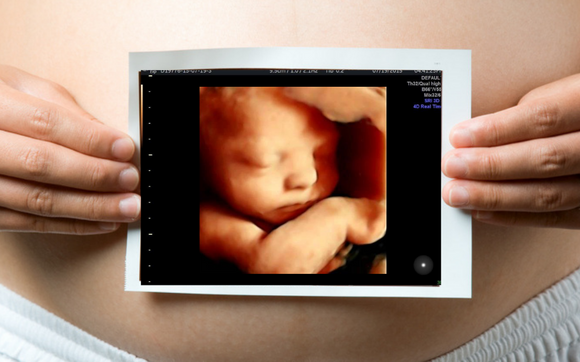 Prenatal 3D/4D 5D Ultrasound Services by Miracle View 3D/4D Ultrasound ...