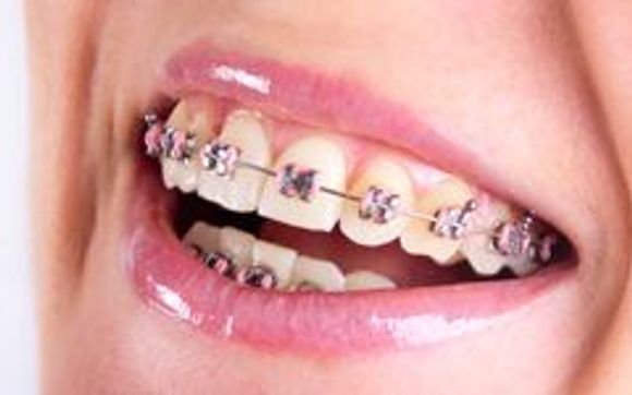 Wild Smiles Braces by VK Orthodontics in San Antonio, TX - Alignable