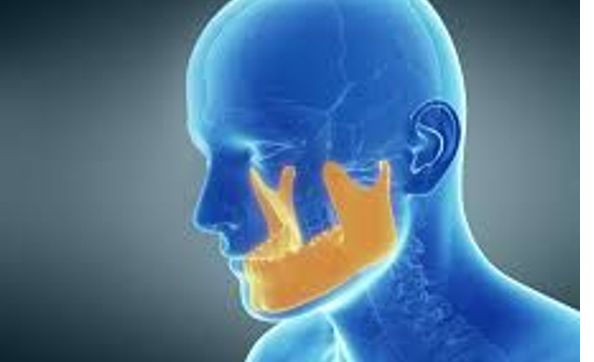 TMJ/TMD Treatment by Tamara Levit DDS PC in North Bethesda, MD - Alignable